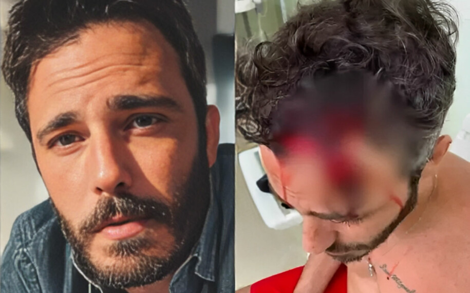 Empresária fala sobre choque de Thiago Rodrigues